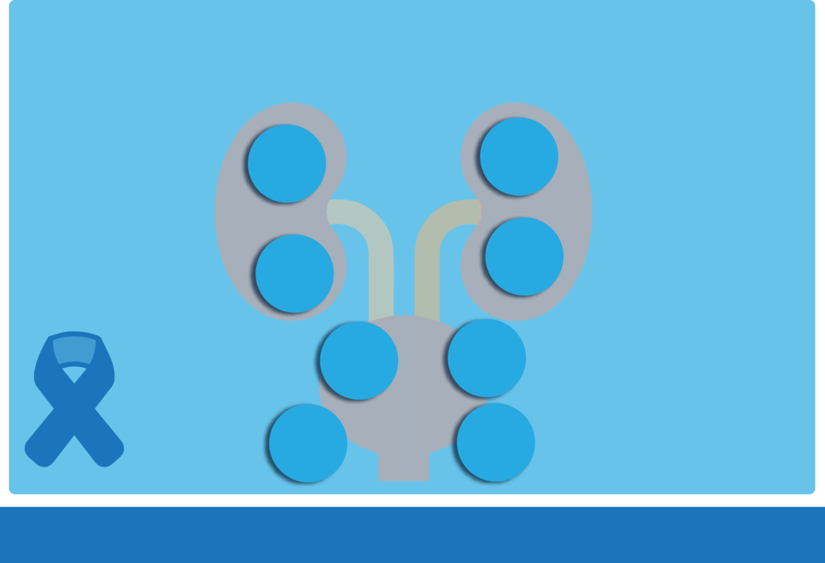 Cáncer de Próstata | Genially