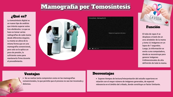Mamografía por Tomosíntesis