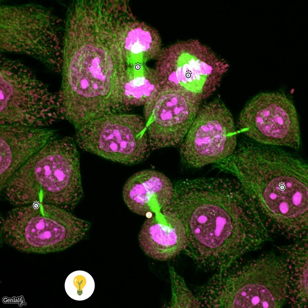 La mitose | Genially