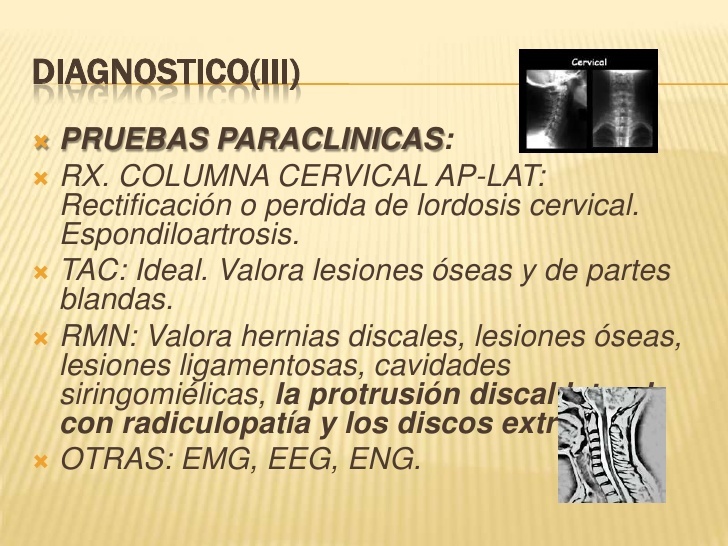 cervical | Genially